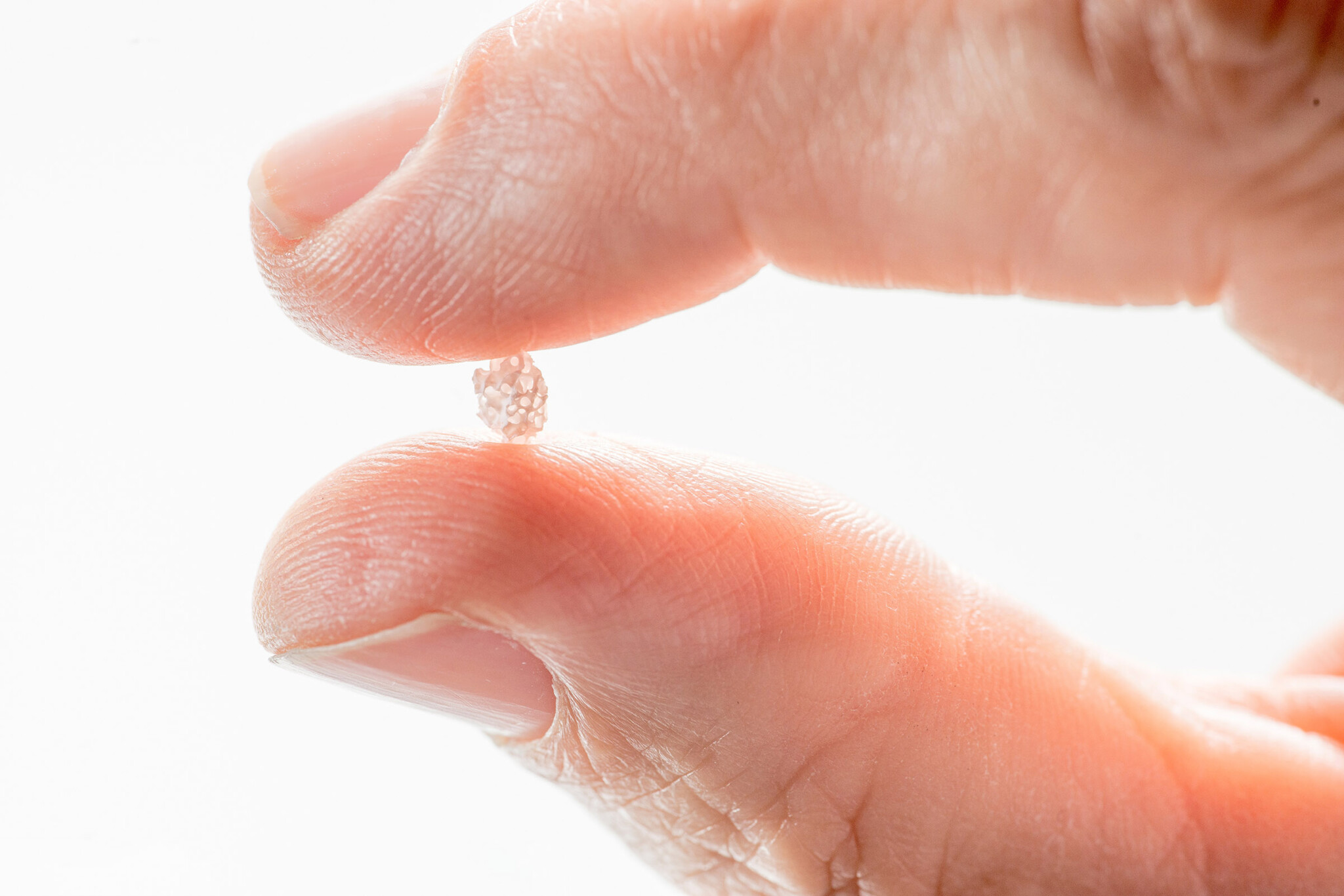 Geistlich Bio-Oss® - The Original Xenograft Bone Substitute