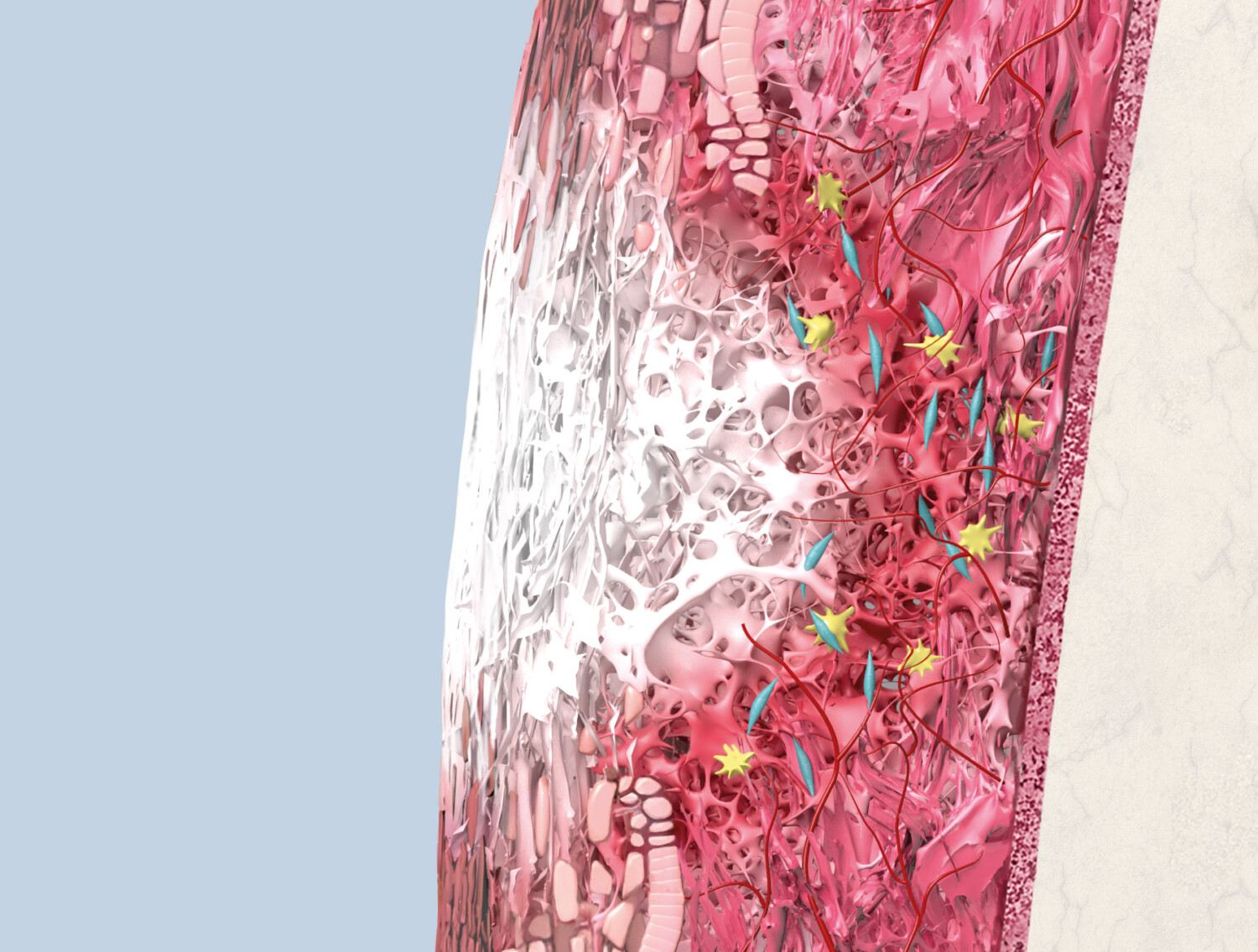 Geistlich Mucograft®- Redefining the Soft Tissue Matrix - Geistlich