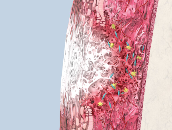 Geistlich Mucograft®- Redefining the Soft Tissue Matrix - Geistlich