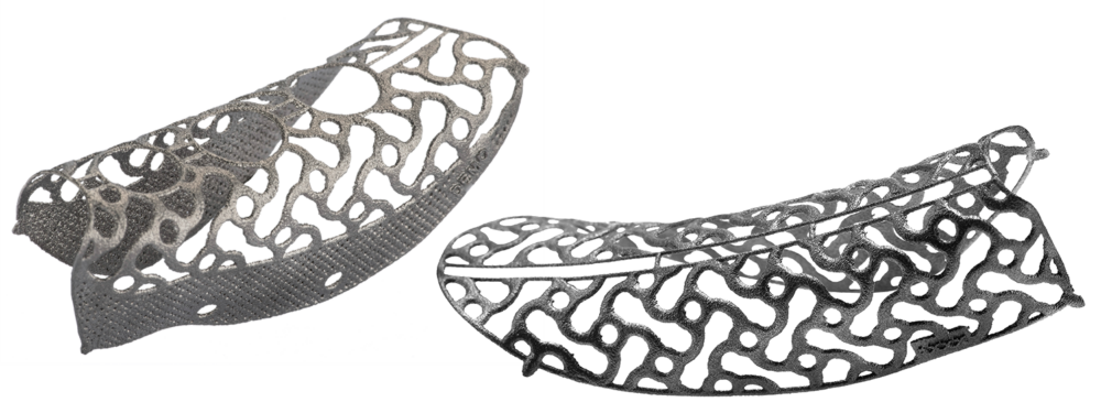 Combined Horizontal and Vertical Regeneration Using a CAD-CAM Titanium ...